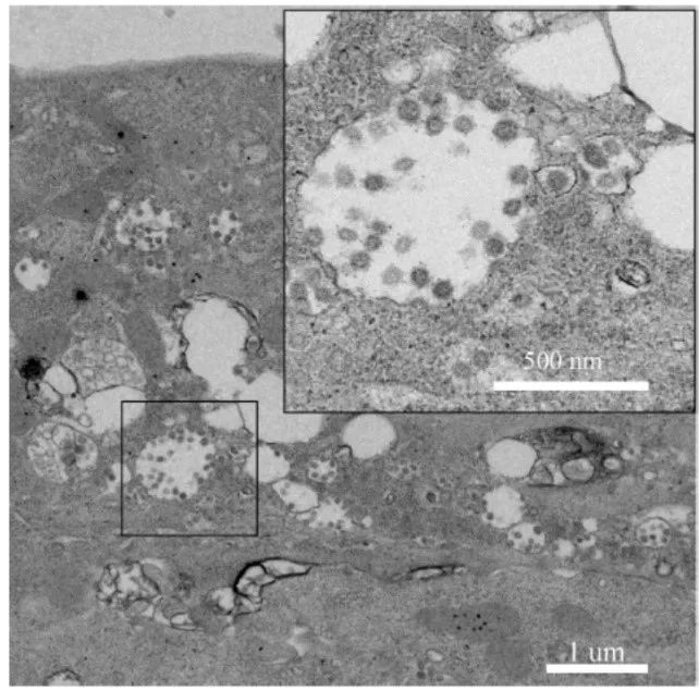 武汉病毒所/生物安全大科学中心揭示新型冠状病毒（2019-nCoV）或来源于蝙蝠_研究