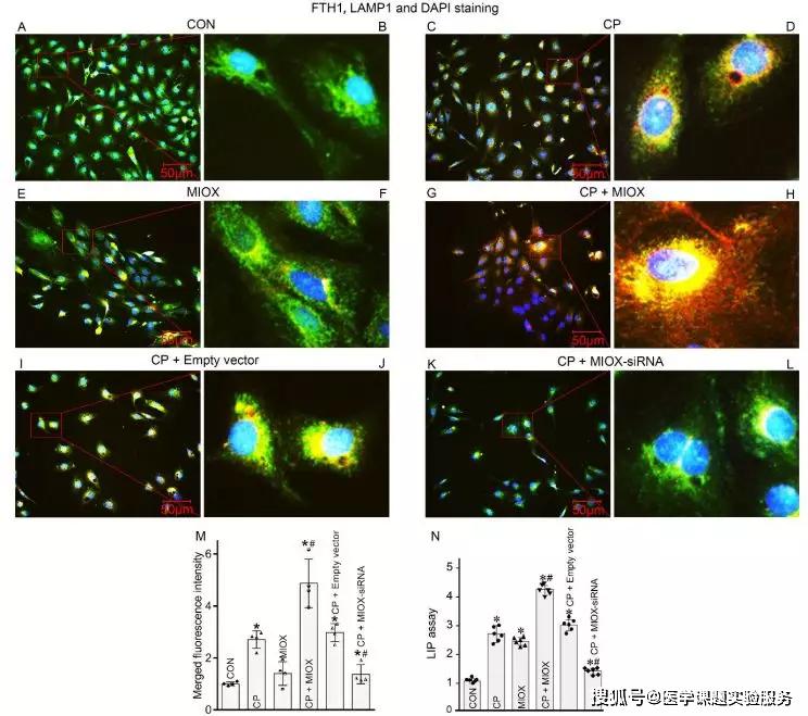 文献导读：肌醇加氧酶（MIOX）调节HK-2细胞病理性铁死亡_Fig