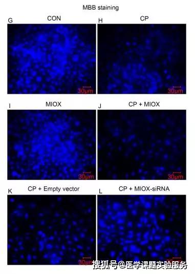 文献导读：肌醇加氧酶（MIOX）调节HK-2细胞病理性铁死亡_Fig