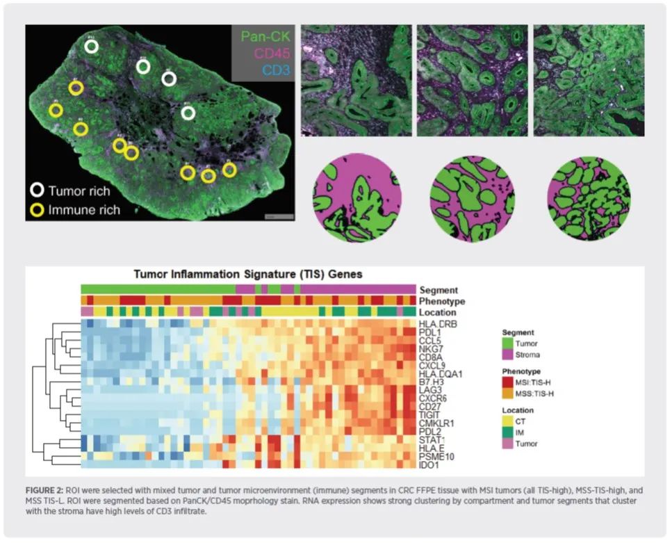GeoMx Digital SpatialProfiler 新一代空间组学解密工具暨中文线上论坛邀请-搜狐大视野-搜狐新闻
