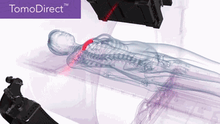 Radixact+RefleXion X1两款放疗设备全新上线！_搜狐汽车_搜狐网
