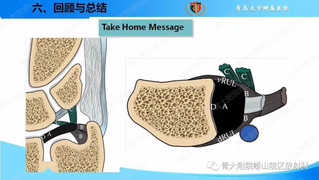 tfcc解剖图-千图网