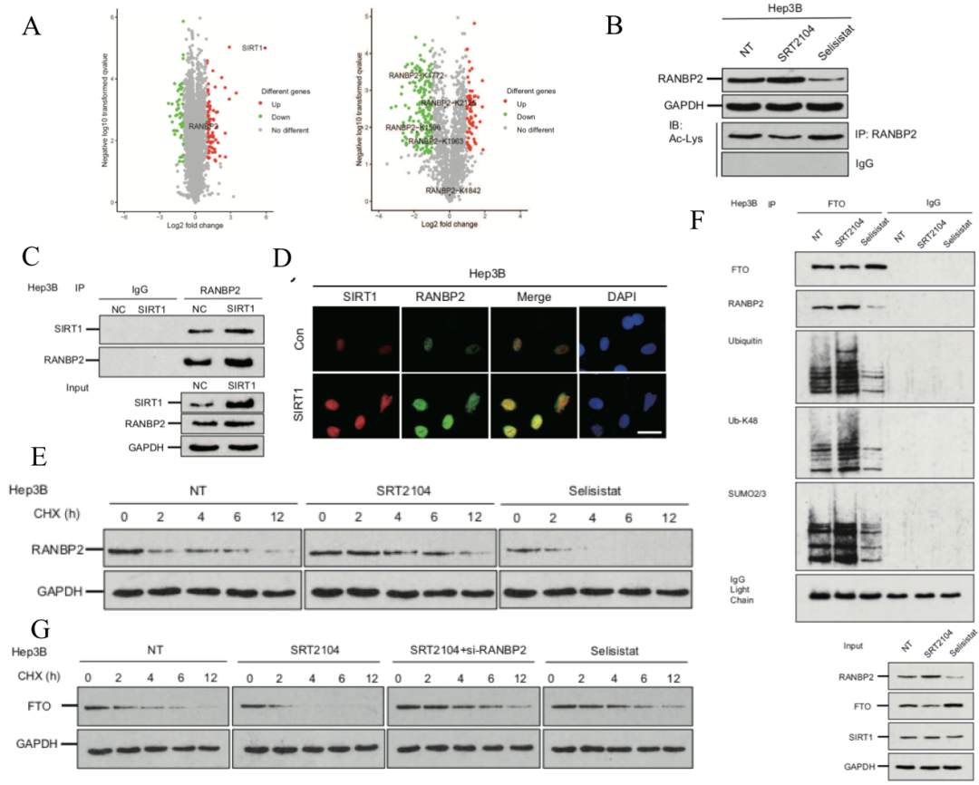 中南大学湘雅三医院曹科团队乙酰化修饰揭示SIRT1调控RNA m6A促进肝细胞癌发生_分析