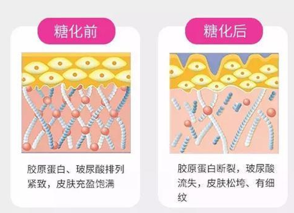 皮肤糖化表现大山谷图库