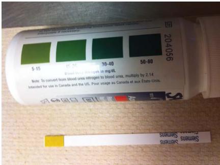 肾功能指标的评估：肌酐、尿素等常见指标的分析_肾脏