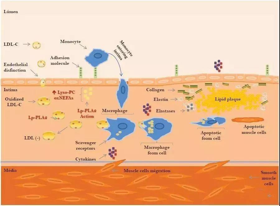 动脉粥样硬化及其危险预警因子-Lp-PLA2_ 脂蛋白