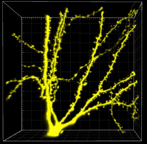 免费3D/4D显微图像查看神器分享！_Imaris