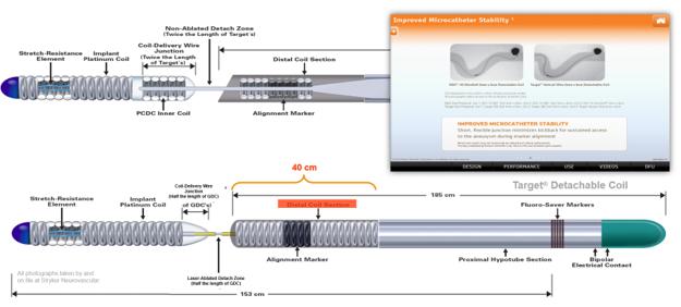术说丨“随遇而安”——Target弹簧圈的临床应用经验_mm