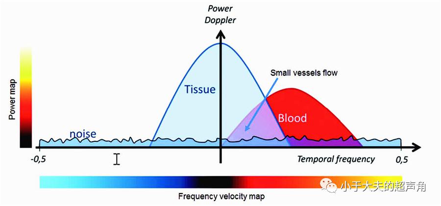Angio Plus - 无创评估微灌注的好帮手-搜狐大视野-搜狐新闻