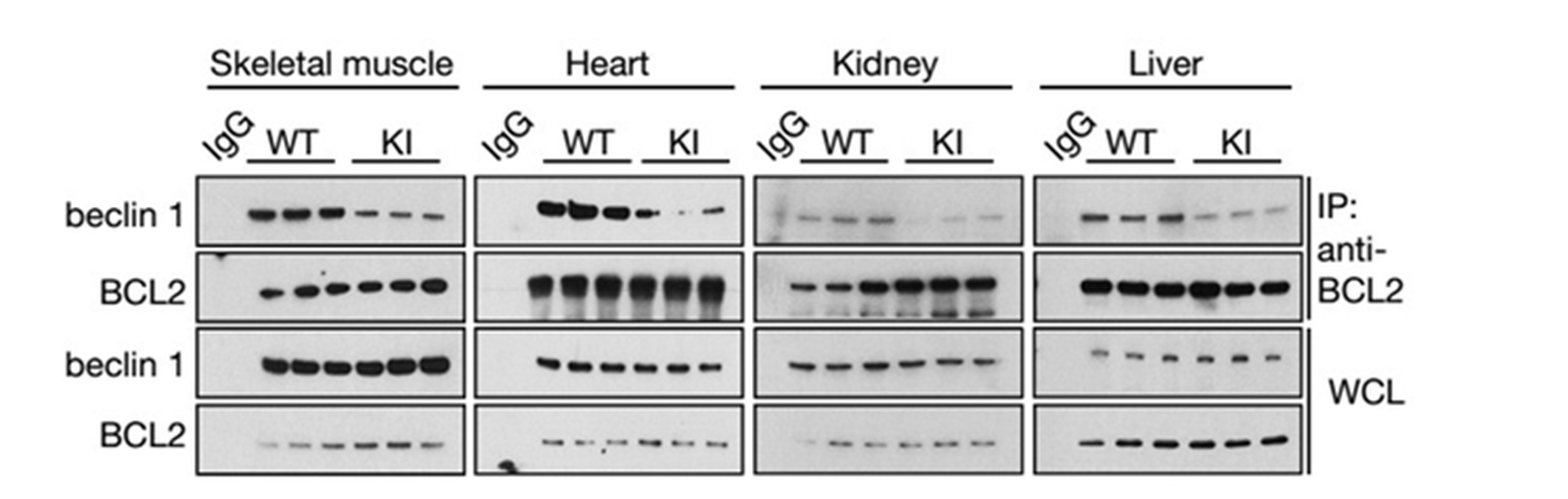 Nature带你走进自噬关键调控蛋白复合物-Beclin 1