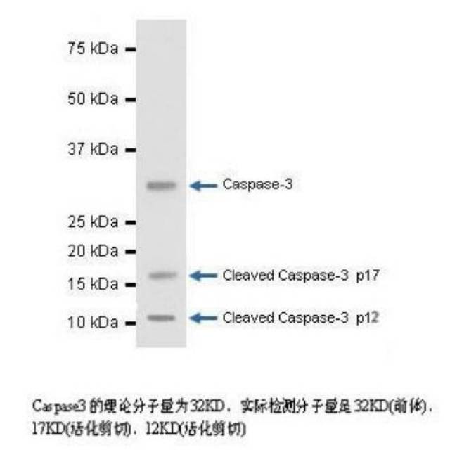 wb上样前为什么要离心,wb上样前样品要离心么,wb先上样还是先补齐_大山谷图库
