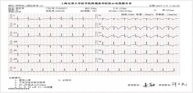 易漏诊、误诊的肺栓塞，心电图有这些特点！｜OCC 2019_手机搜狐网